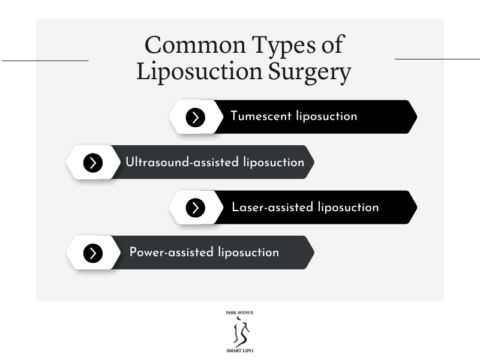 What You Should Know About Anesthesia Used for Liposuction